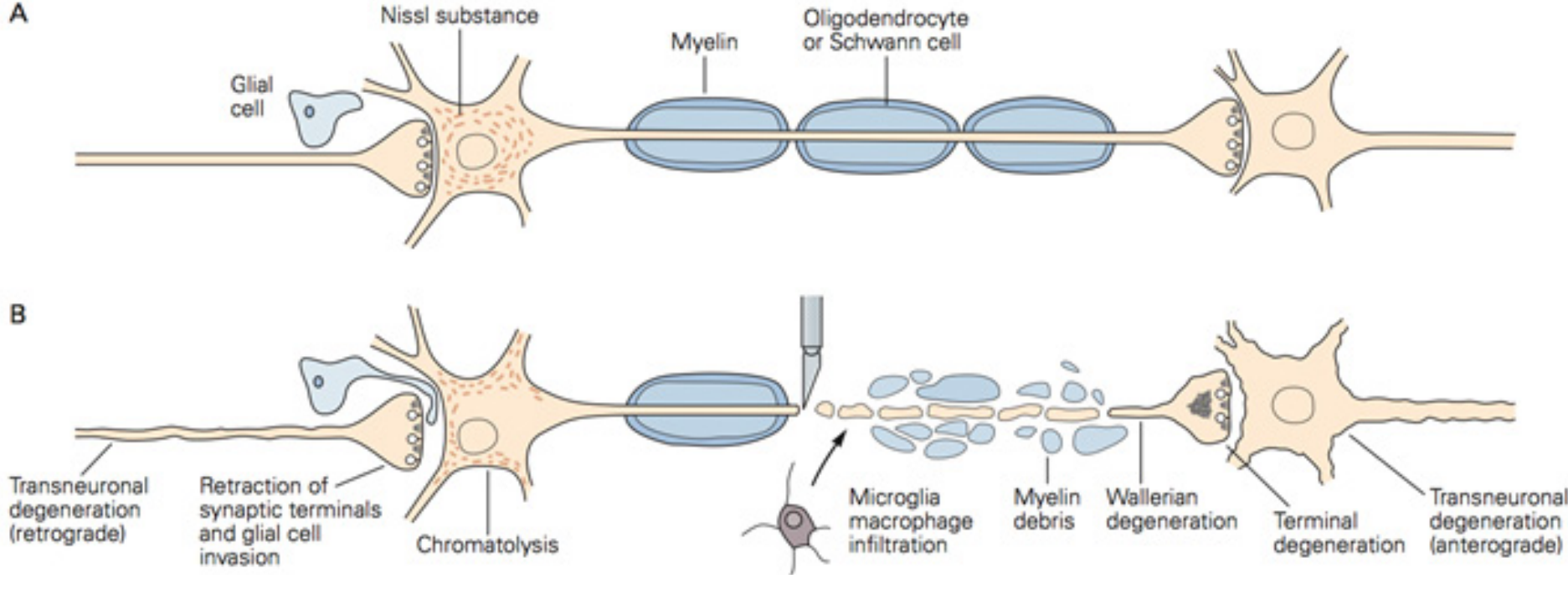 Brain Damage Repair - MedPress - Le Magazine Estudiantin