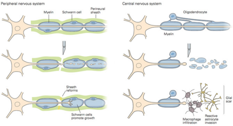 Brain Damage Repair - MedPress - Le Magazine Estudiantin